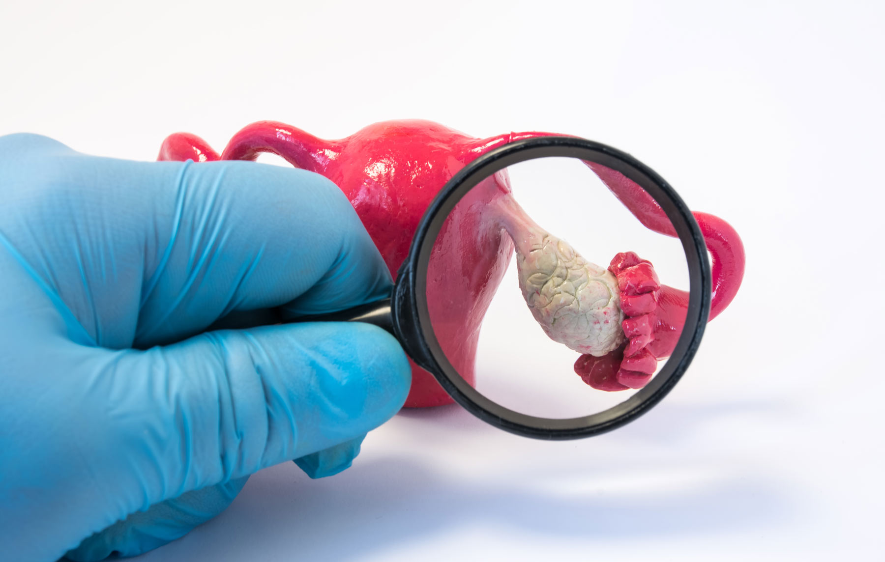 Follicle Tracking Scan | Top London IVF & Fertility Clinic