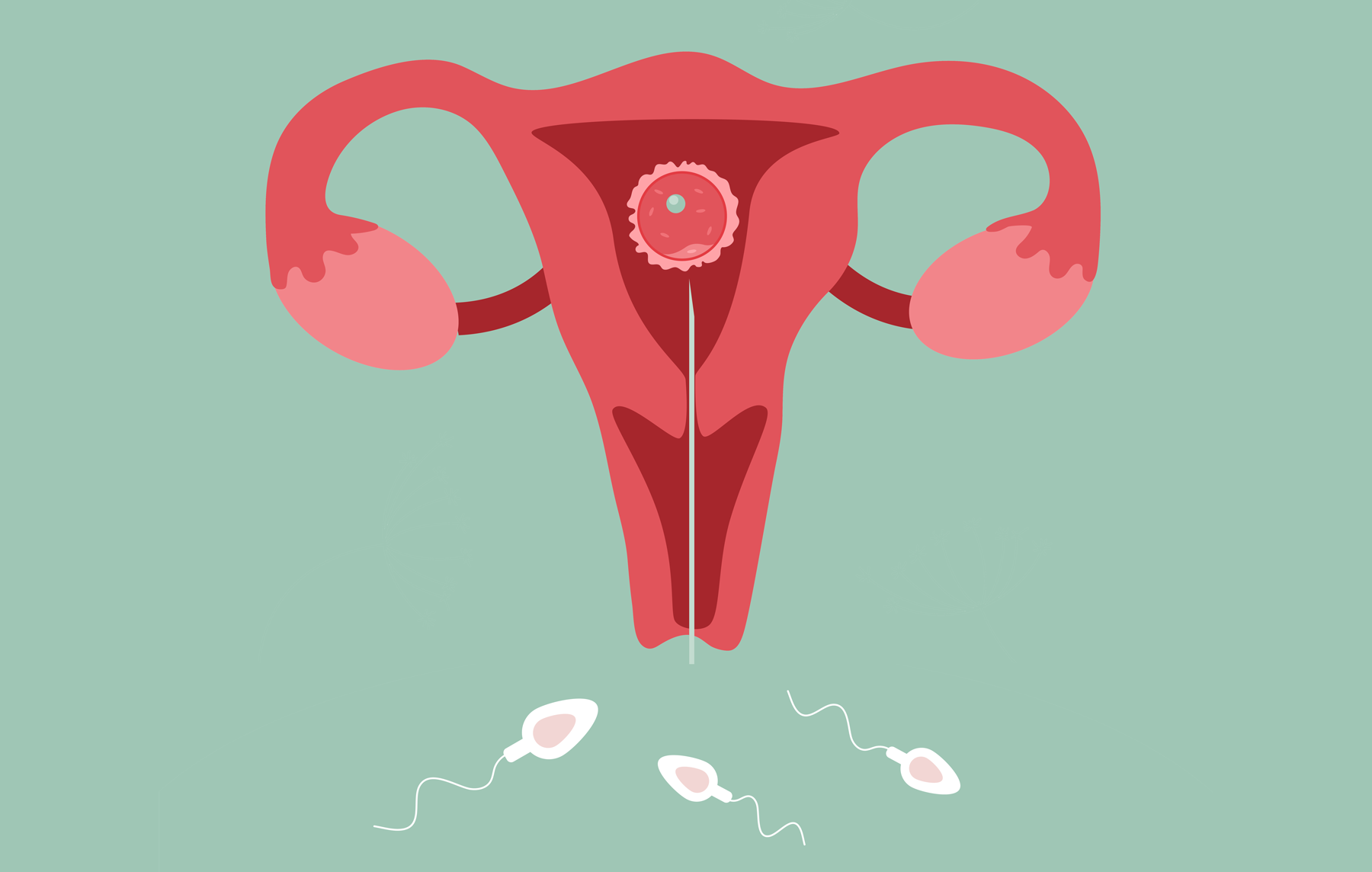 Intrauterine Insemination (IUI) At Leading London Fertility IVF Clinic