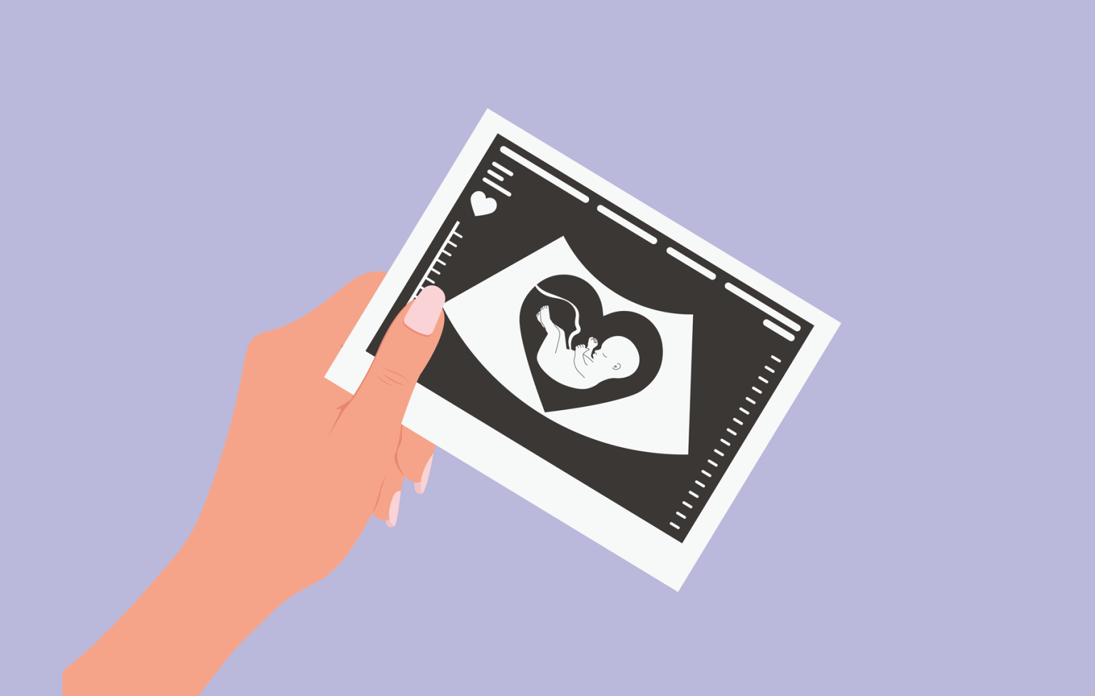 Pregnancy Scans At The Fertility & Gynaecology Academy, London