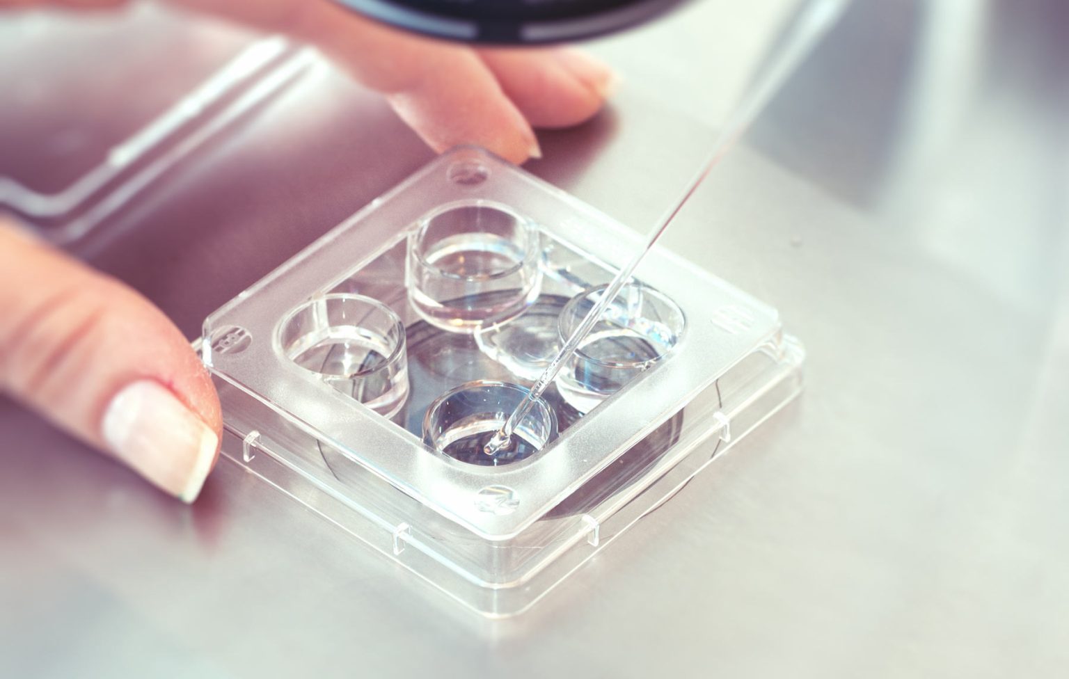 Surgical Sperm Aspiration, Sperm Collection And Retrieval